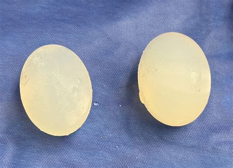 Custom Testicle Implants An Overview Explore Plastic Surgery