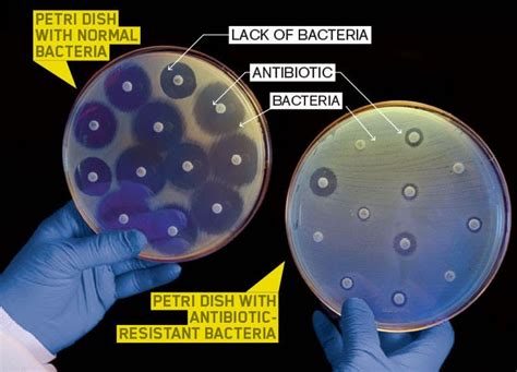 Resistant Vs Non Resistant Bacteria
