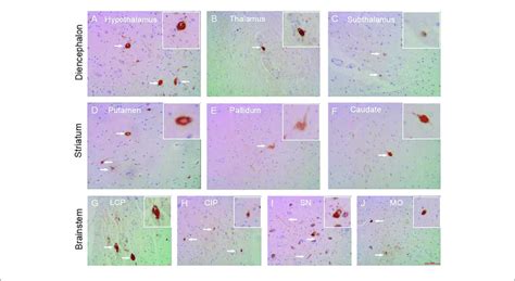 Subcortical Nuclei Tau Distribution In Part Tau Pathology In The Download Scientific Diagram