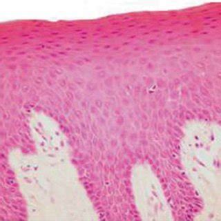 Mucosa Oral Normal Mon He 100x Download Scientific Diagram