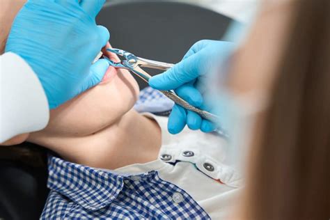 What Is A Dry Socket And How Can You Avoid Them