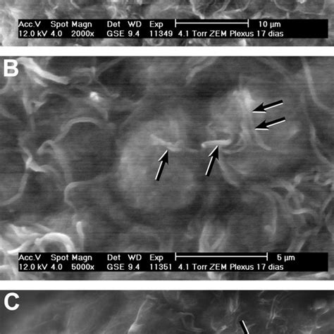 Scanning Electron Microscopy Of Choroid Plexus At Low Vacuum Ad
