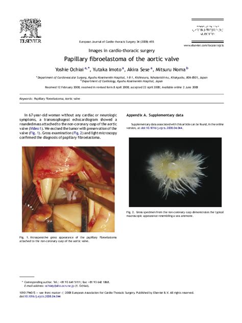 Pdf Papillary Fibroelastoma Of The Aortic Valve