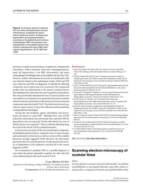 Pdf Scanning Electron Microscopy Of Scutular Tinea Dokumen Tips