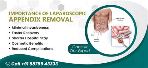 Top Rated Appendix Removal By Laparoscopy In Kota Jindal Laparoscopy