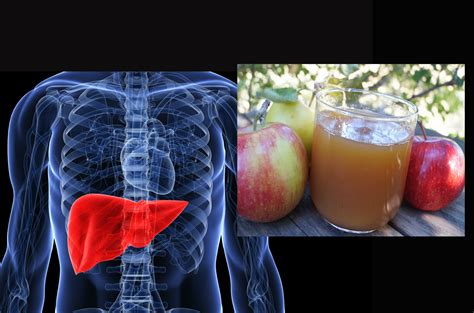 როგორ გავიწმინდოთ ღვიძლი დღესასწაულების შემდეგ Gemrielia Ge