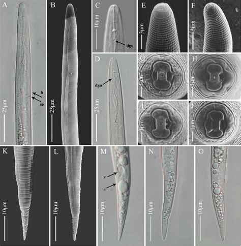Figure 1 From A New Root Knot Nematode Species Meloidogyne Karsseni N