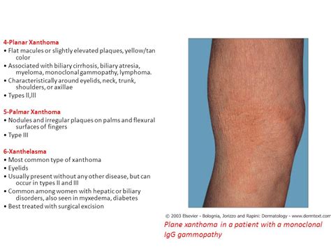 Plane Xanthoma