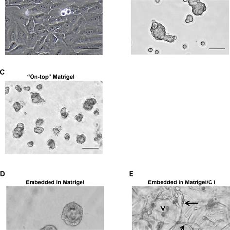 Mammosphere Culture Of Mcf10a Cells A Mcf10a Cells Subjected To