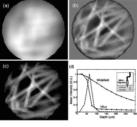 Figure 3 From Optically Sectioned Fluorescence Endomicroscopy With