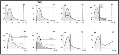 Interpretation Of Normal Platelet Histogram Normal Platelet Histogram