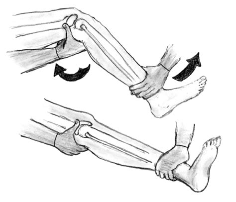 Knee Dislocation Maimonides Emergency Medicine Residency