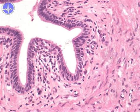 Ductus Deferens Sflt Wikiskripta