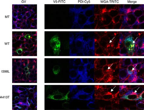 Subcellular Localization Of Wt I398l And A413t Fi Subcellular Download Scientific Diagram