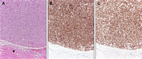 Case 1 Gist Surgical Resection Pathology Findings Notes A Download Scientific Diagram