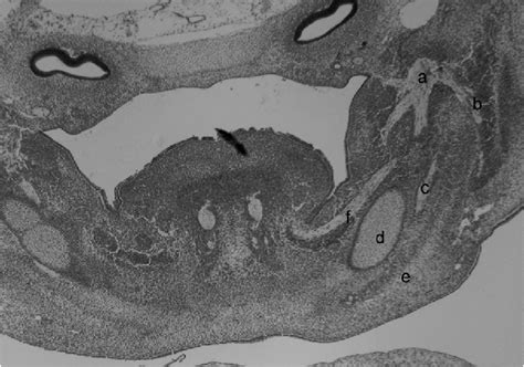 Figure 1 From Skeletal Units Of The Human Embryonic Mandible