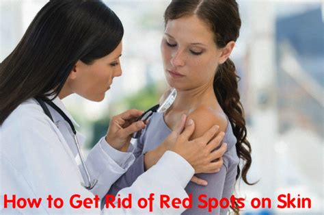 How To Get Rid Of Red Spots On Skin Different Ways Stylish Walks