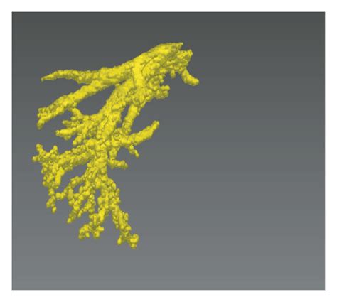 Comparison Of The Improved Fuzzy Connectedness Fc Method With Download Scientific Diagram