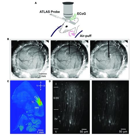 Scheme Of The Experimental Setup Probe Insertion And Reconstruction Download Scientific