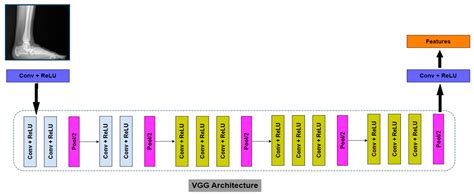 A Novel Model Based On Cnn Vit Fusion And Ensemble Learning For The Automatic Detection Of Pes
