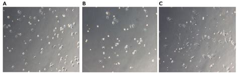Primary Human Hepatic Kupffer Cell Culture Protocol