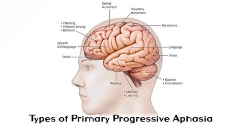 Treatment Options For Primary Progressive Aphasia