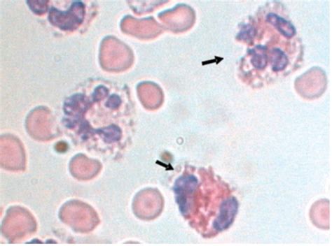 Csf Cells Practical 1 Flashcards