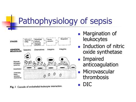 Ppt Sepsis And Cardiac Output Measurement Powerpoint Presentation Free Download Id 593206