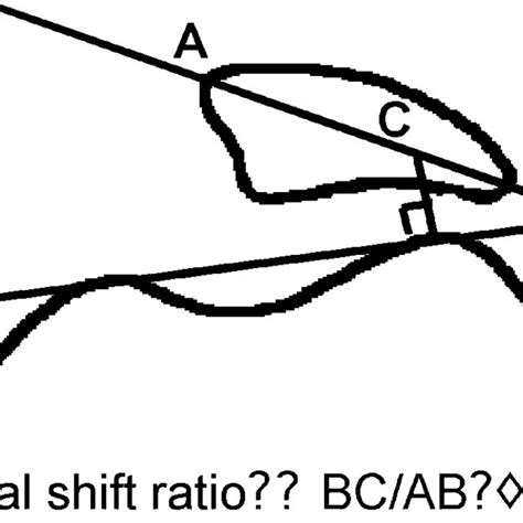 The Tibial External Rotation Angle I E The Angle Between The Download Scientific Diagram
