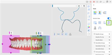 Overview Mode Medit Help Center