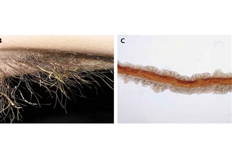 Smells Like An Armpit Infection Live Science