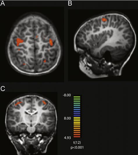 Figure 2 From The Effects Of Handwriting Experience On Functional Brain Development In Pre
