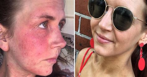 If We Have Sex We Ll Have To Turn The Lights Off Melbourne Woman S Experience Of Dating With