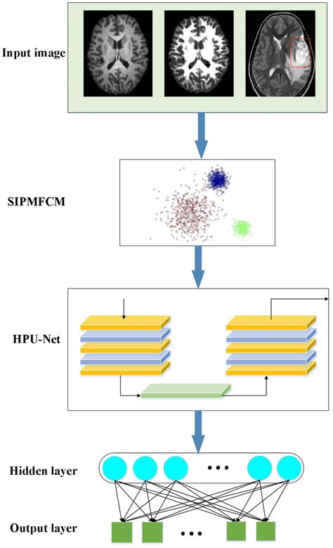 Frontiers Fuzzy System Based Medical Image Processing For Brain