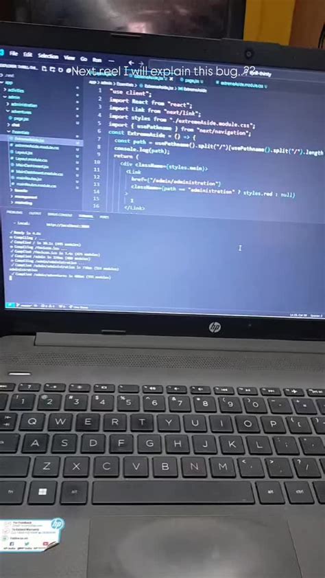 Sonu Kishor 🤡 Codingbootcamp Computerscience Coder Javascript