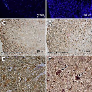Staining With DAPI A And B GFAP C And D And TUNEL E And F In Download Scientific