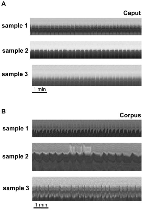 Visualization Of Contractility Derived From Virtual Sections Through Download Scientific