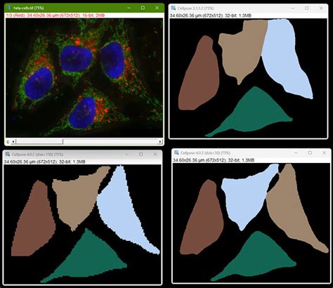 Cellpose Gui Installation Issues And Potential Solution Usage And Issues Imagesc Forum