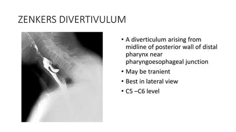 Upper Gi Fluro Exam Pptx
