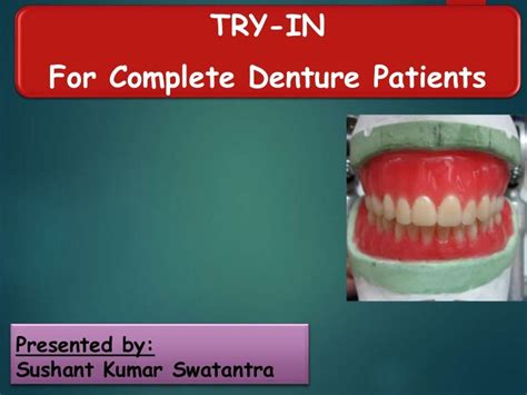 Denture Tooth Shade Conversion Chart At Jeanne Phillips Blog