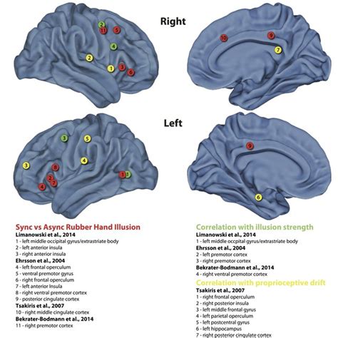 Schematic Representation Of The Main Cortical Vestibular Areas A Download Scientific Diagram