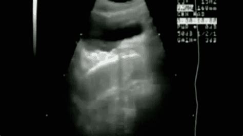 What Sex Looks Like In D Ultrasound Iflscience