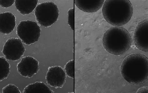 neandertalized mini brains yield clues to modern human uniqueness