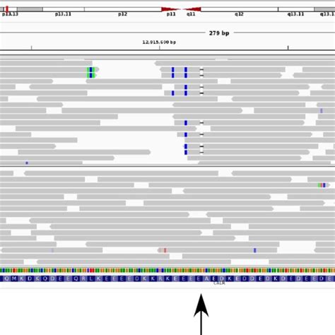 Figure S2 Imperfect Alignment Of Whole Exome Sequencing Reads In Download Scientific Diagram