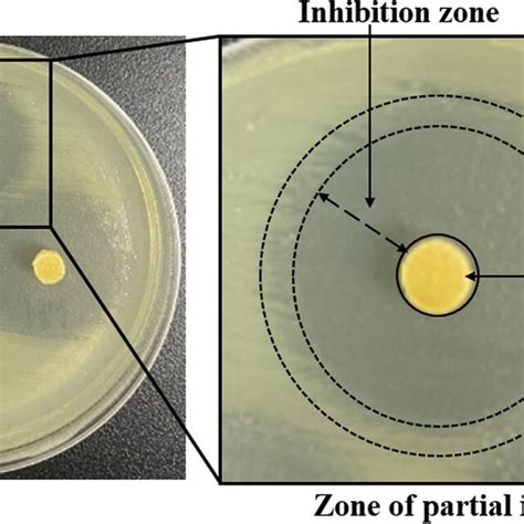 Schematic Representation Of Inhibition Zone Evaluation Test Image Download Scientific Diagram