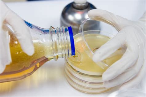 The Pour Plate Method Stock Image Image Of Health Media 89483779