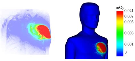 5 Visualization Of A Patient Radiation Exposure To Skin And Organs