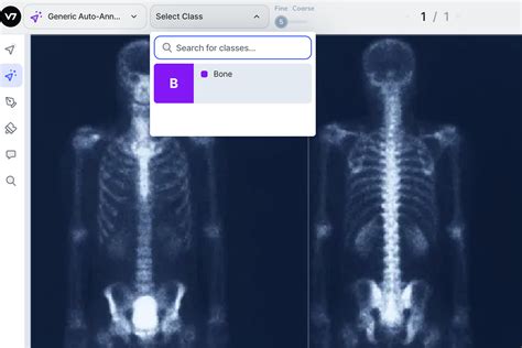 Stage Specific Classes