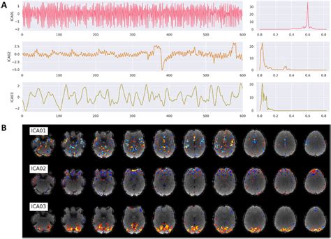 Example Of Ica Output Figures Generated By Fmriflows After Executing Download Scientific