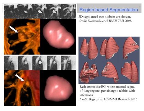 Lec8 Medical Image Segmentation Ii Region Growing Merging